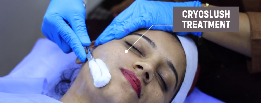 Cryoslush – drpratikshivhare.com