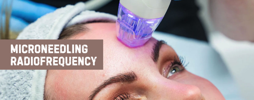 Microneedling Radiofrequency – drpratikshivhare.com